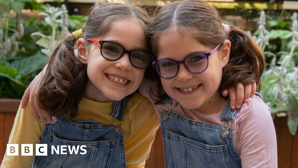 Hertfordshire twin sisters born with cataracts are 'thriving' - BBC News