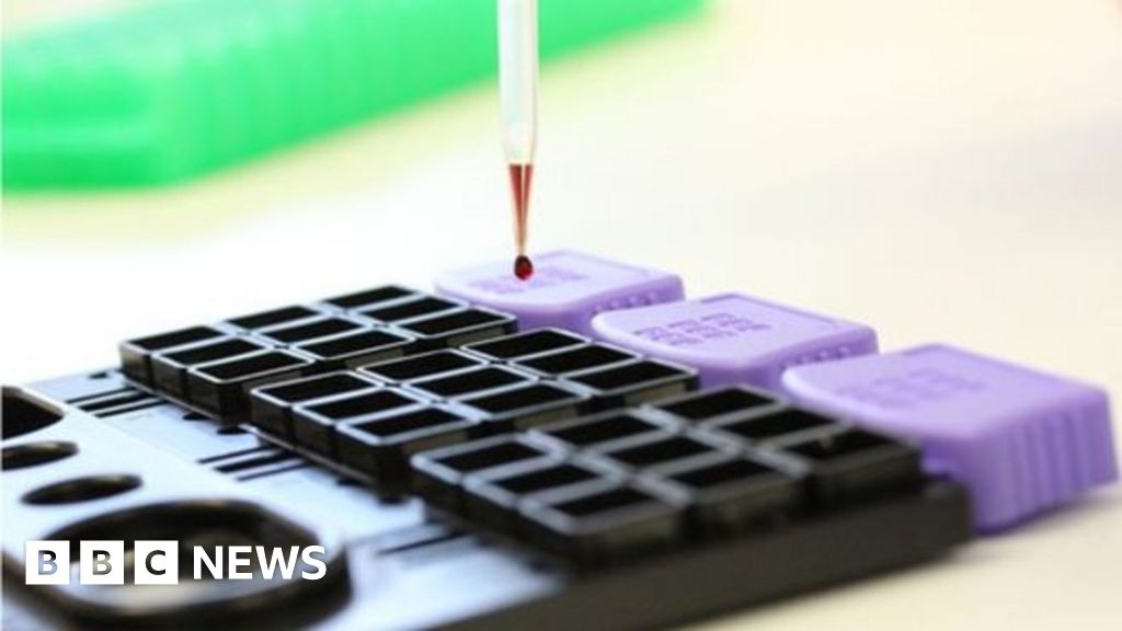 Antrim healthcare diagnostics firm Randox records £18m pre-tax profit - BBC News