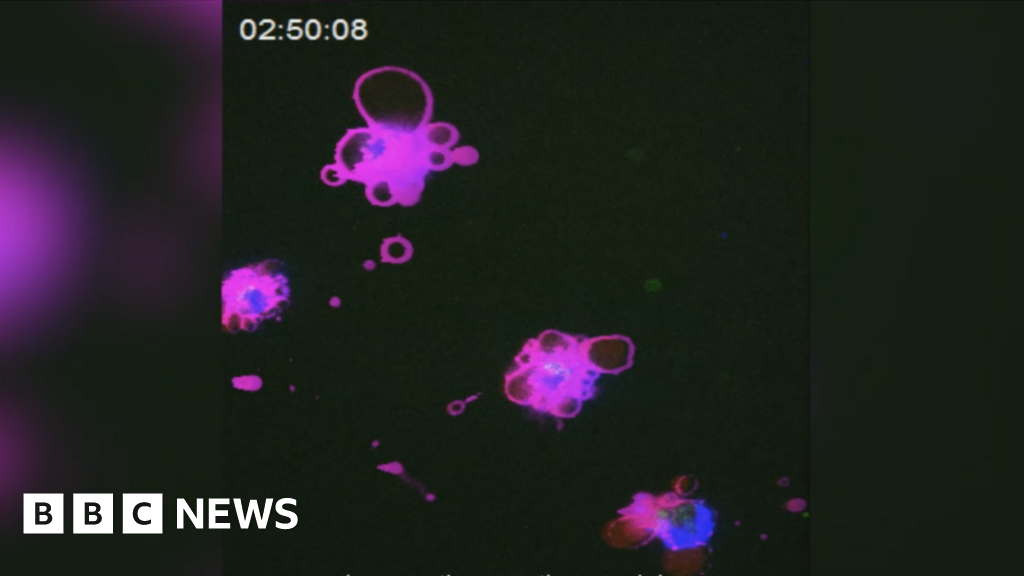 New treatment destroys cancer cells in Glasgow University study - BBC News