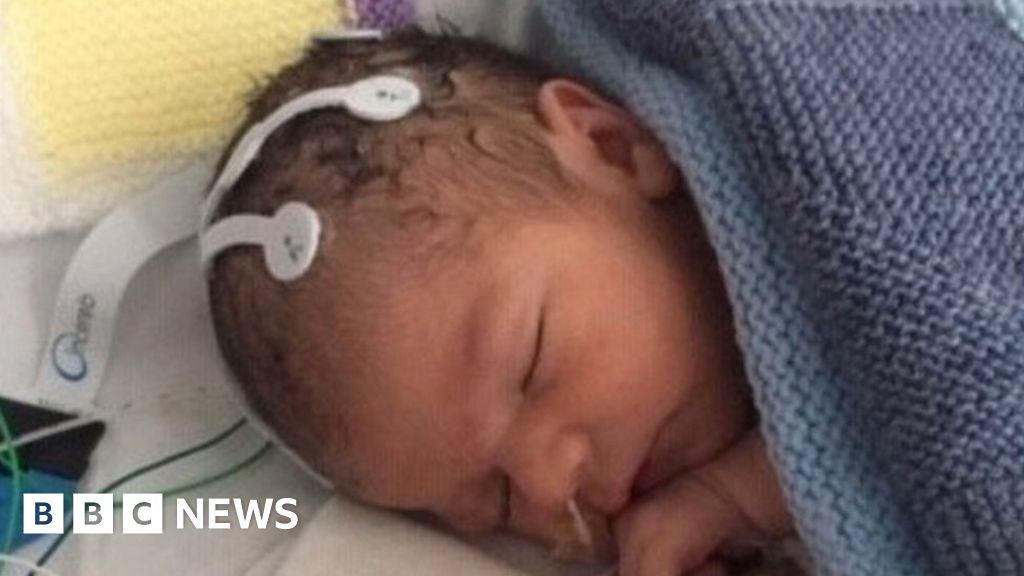 Baby given cannabis-based drug in medical first in Norfolk - BBC News