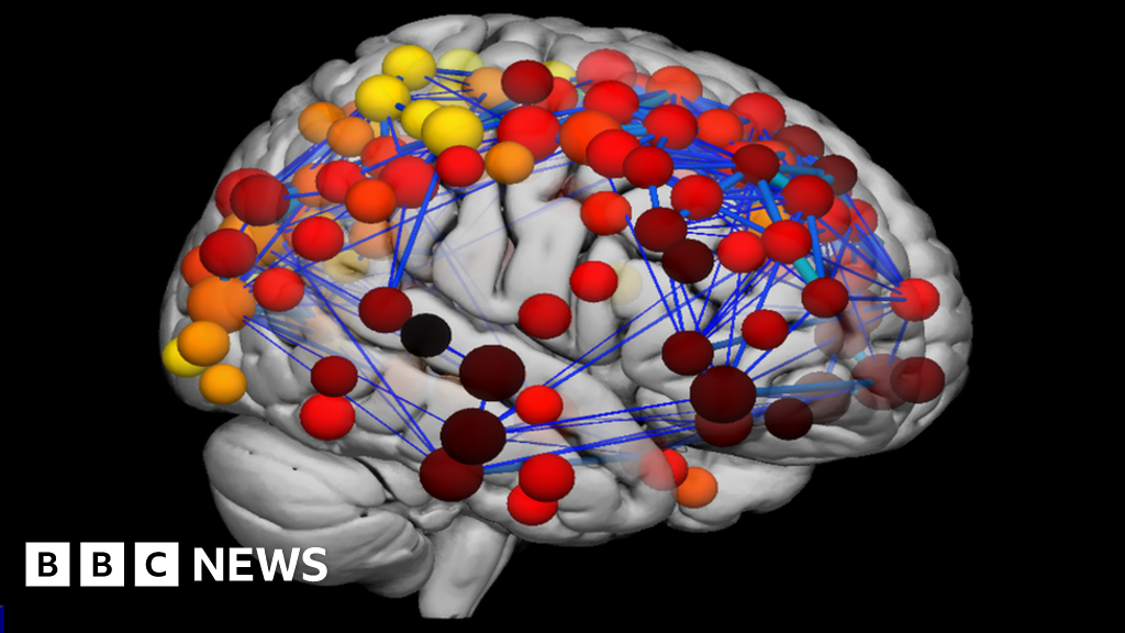 Scans reveal how teenage brain develops - BBC News