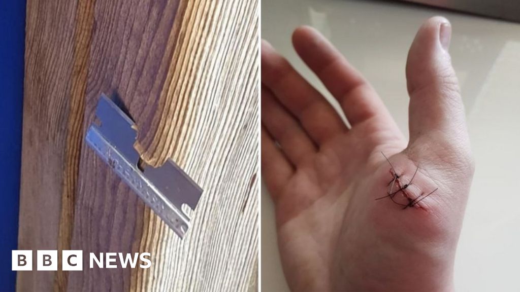 Man slashed on razor wedged onto slide in Bathgate park - BBC News