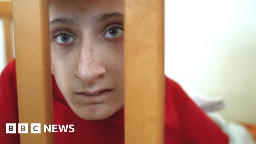 UN: Disabled people used as human shields by Russia