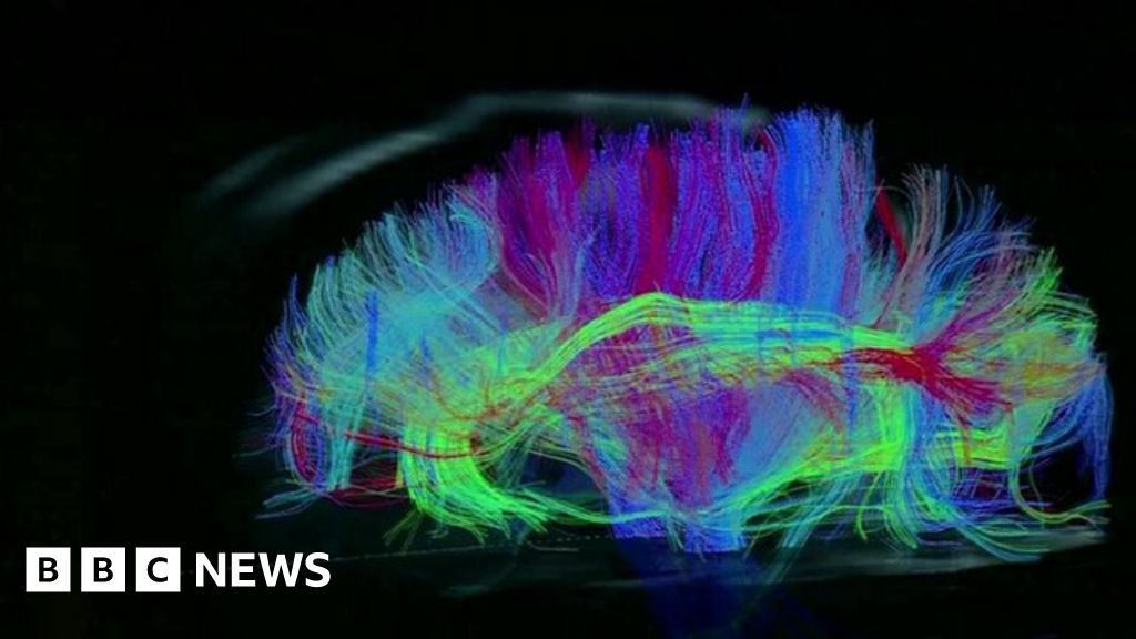 Brain imaging explores treatments for mental illness - BBC News