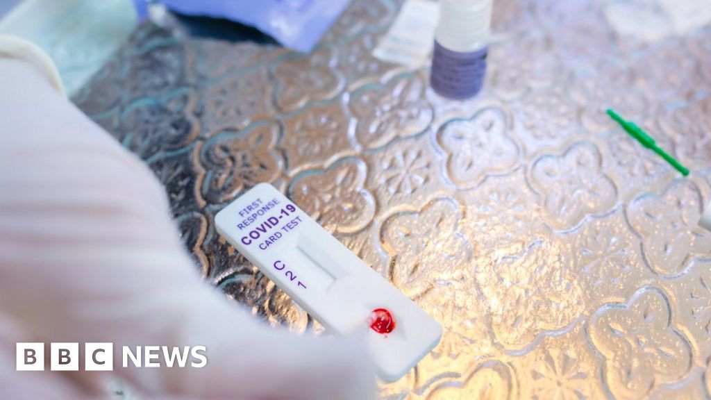 Covid tests for patients in Oxford before hospital transfers