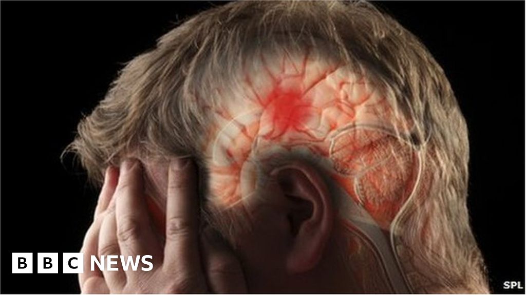 NHS continues to miss stroke admittance target - BBC News