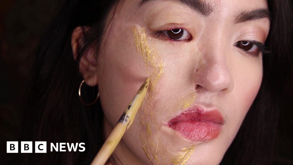 'Why I turned my scars into artwork' - BBC News