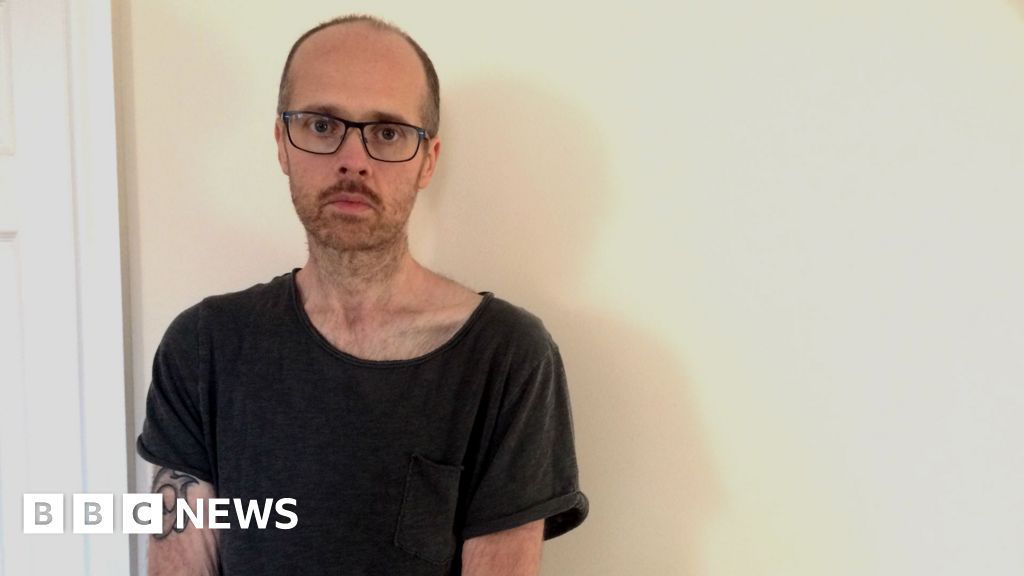 Not enough support for men with eating disorders, charity says - BBC News