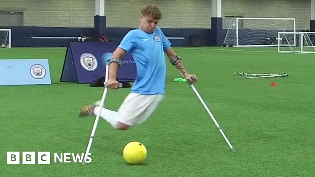Man City's amputee football star Jamie Tregaskiss - BBC News