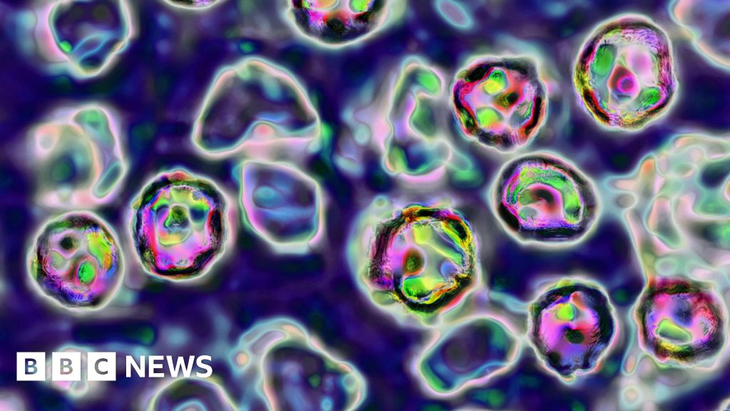 Measles: How a preventable disease returned from the past