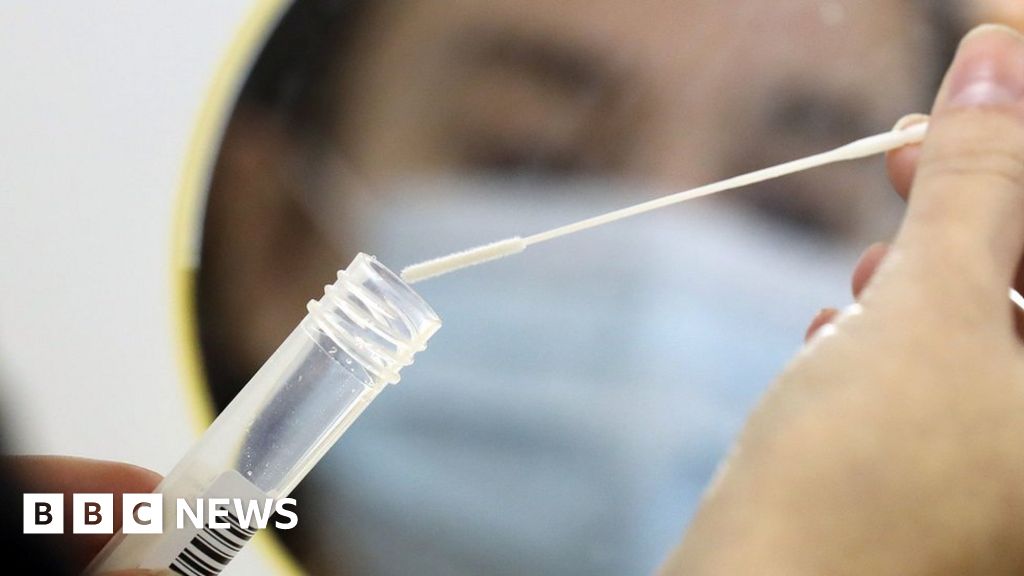 Covid-19: How to prepare for a possible winter wave