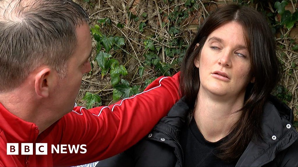 Nead: Eastbourne woman suffers up to 20 seizures a day - BBC News