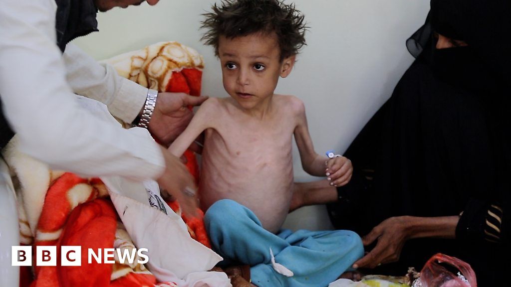 Starvation in Sanaa: 1,000 days of Yemen's civil war - BBC News