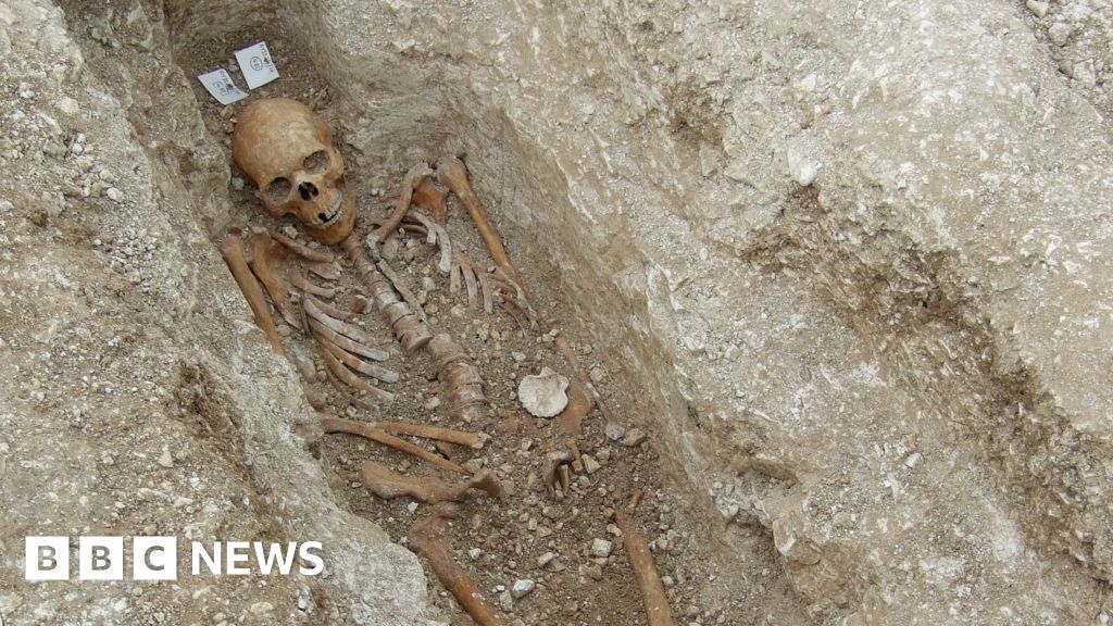 Skeleton offers clues to medieval spread of leprosy - BBC News
