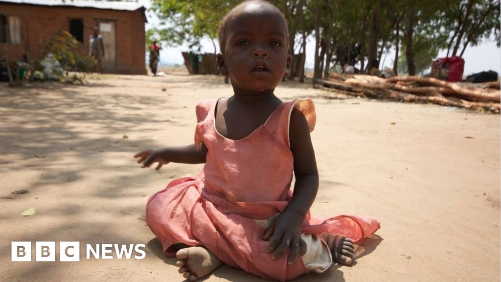 Africa 'set to miss UN development goal on malnutrition' - BBC News