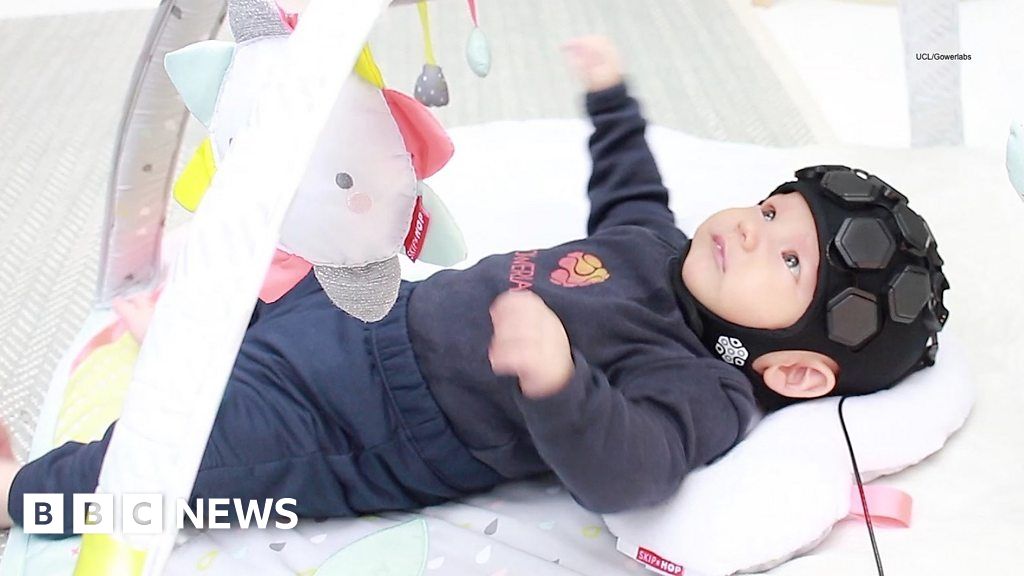 Brain imaging technology designed for babies