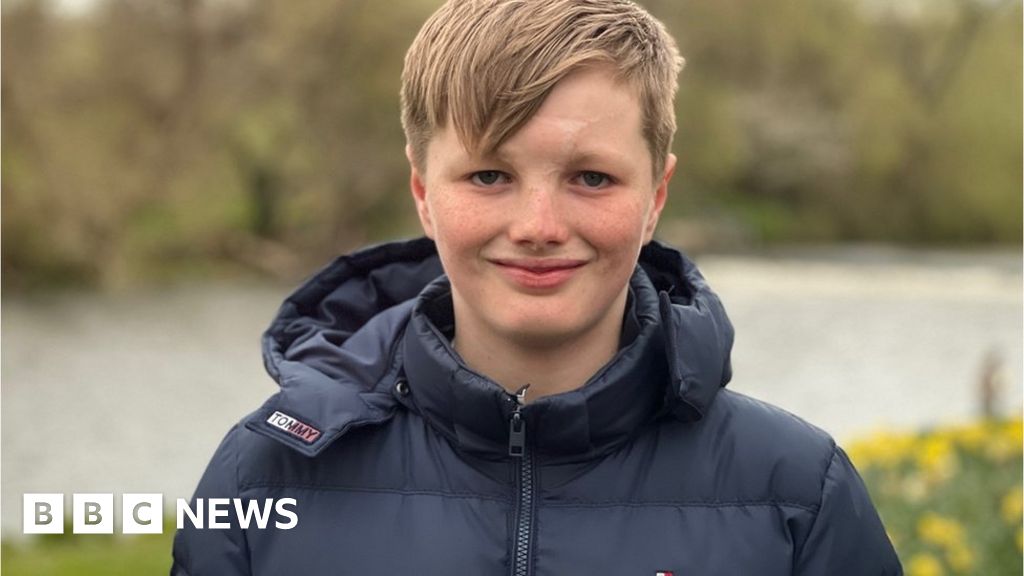 County Durham boy scarred in crash raises £20k for charity - BBC News