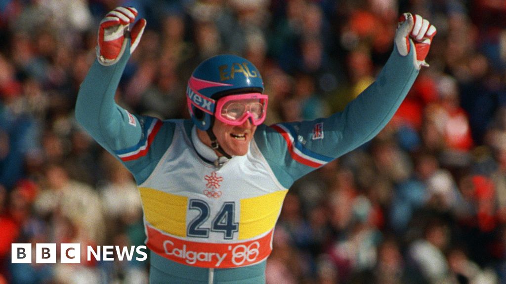 Eddie The Eagle: The Jump producers are 'not to blame' for injuries ...