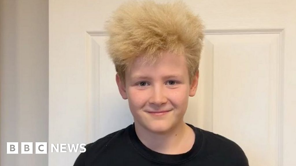 Uncombable hair syndrome: 'It's OK to have rare hair' - BBC News