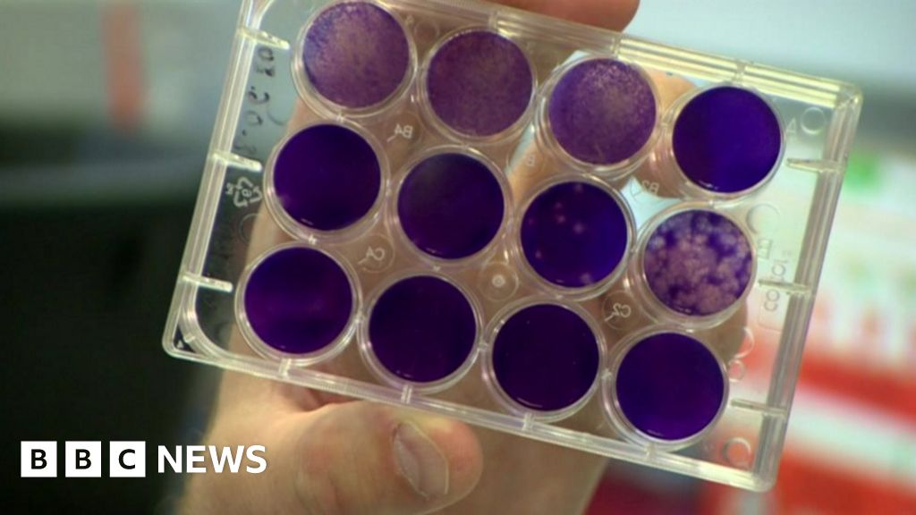 Coronavirus: Covid-19 samples tested in Belfast laboratory - BBC News