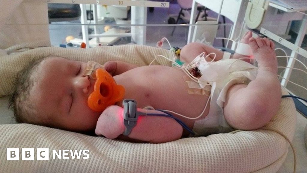 Newborn baby died after mistake by Bristol hospital doctors - BBC News