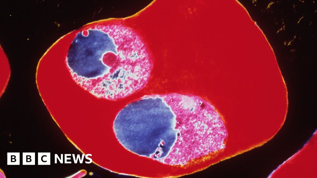 Drug-resistant malaria can infect African mosquitoes - BBC News