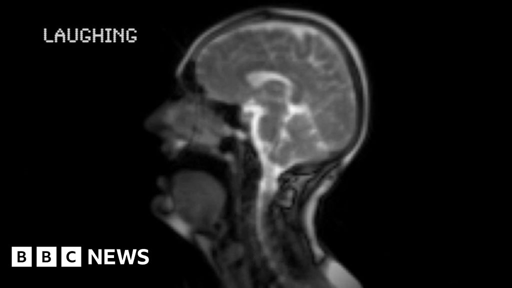 How our bodies work when we laugh - BBC News