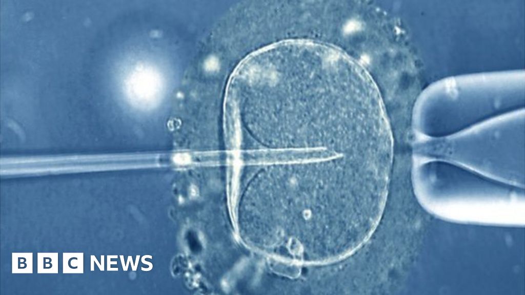 IVF costs to NHS 'must be capped', says fertility expert - BBC News