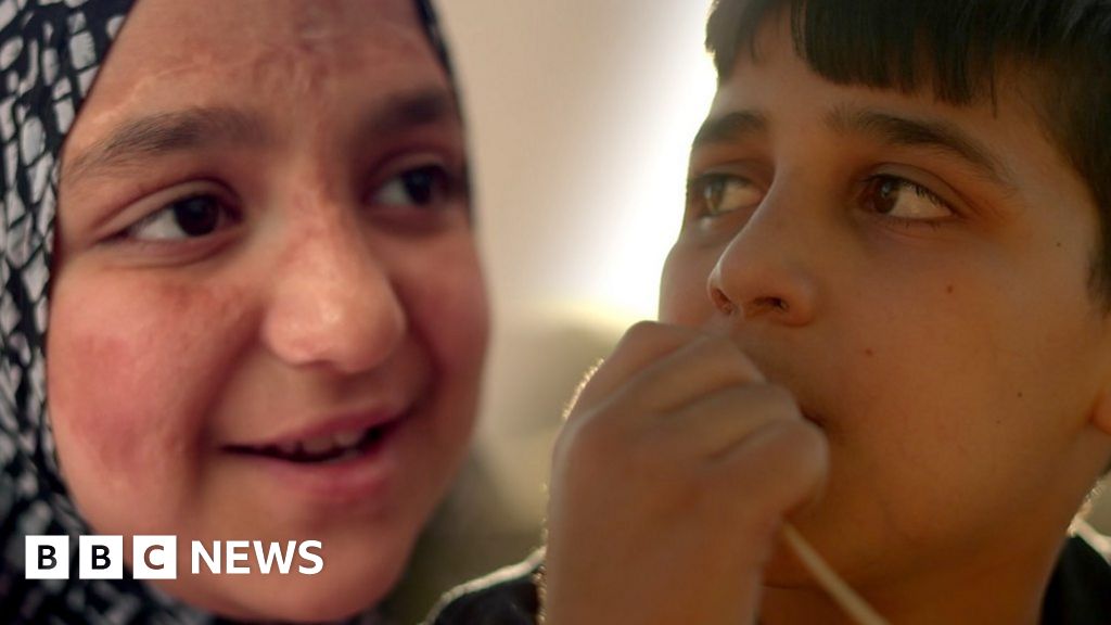 Two children, a decade of war in Syria
