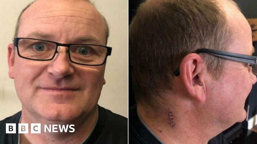 Leeds minicab driver stabbed in neck over £3 fare
