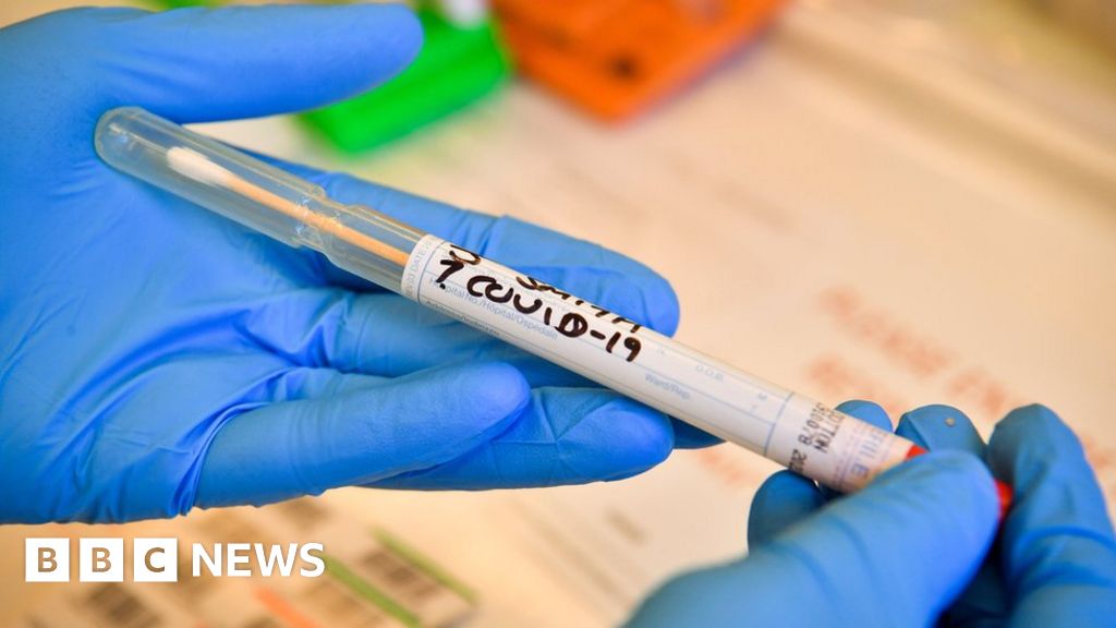 Concerns voiced over 'false' virus test results