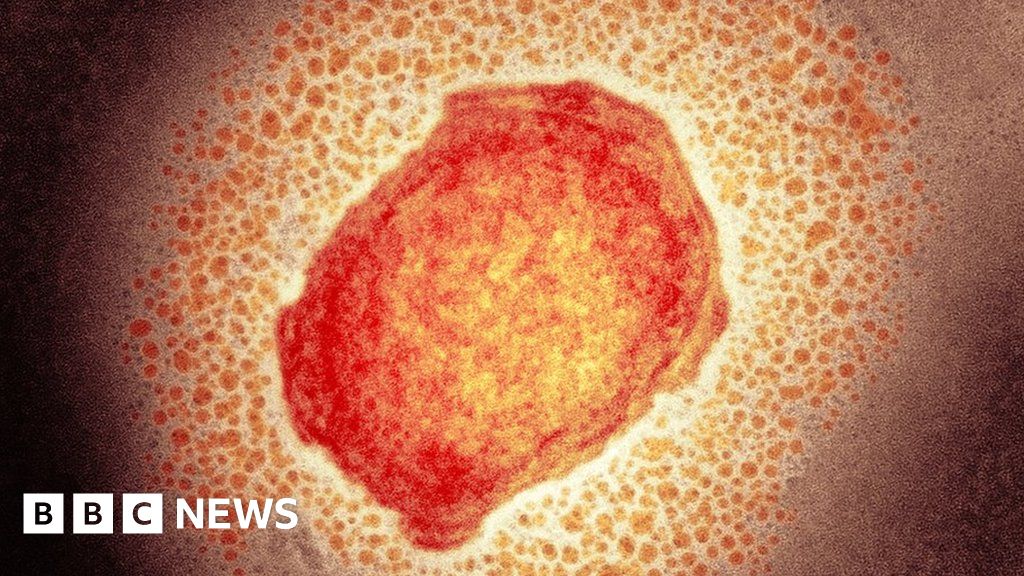 Monkeypox: Three people vaccinated in Bristol and Exeter