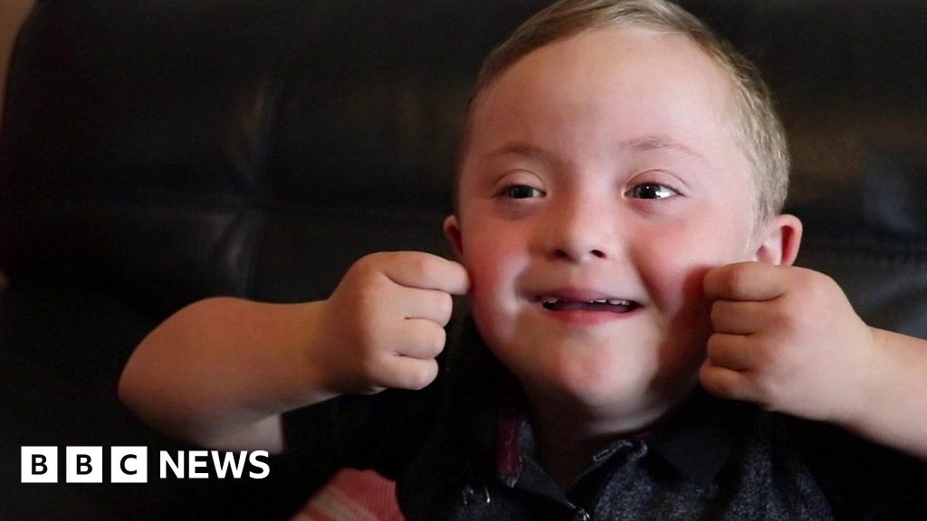 Little boy with Down's syndrome wows Gateshead shoppers