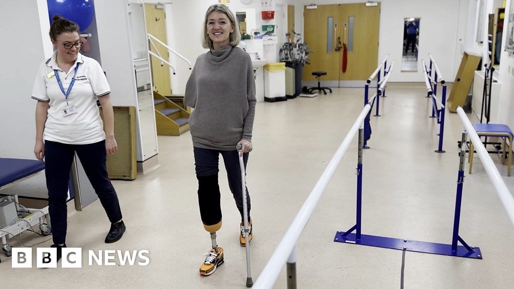 London Underground: Woman run over by two trains fundraises for bionic arm
