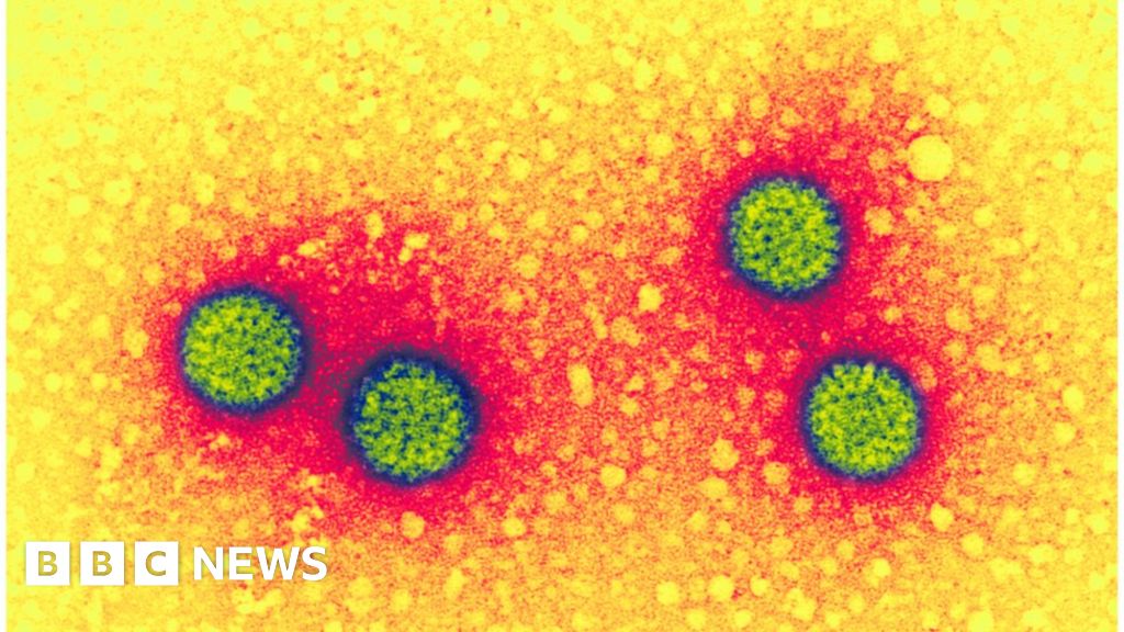Children's ward closed amid bug fears - BBC News
