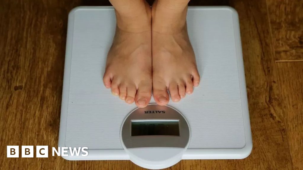 One in four Jersey children aged 4-5 overweight or obese - report