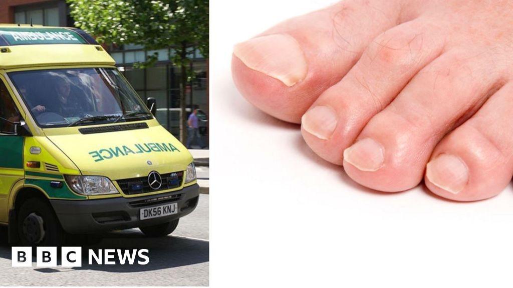 Cut toenail and 'sprained buttock muscle' among 'inappropriate' 999 ...