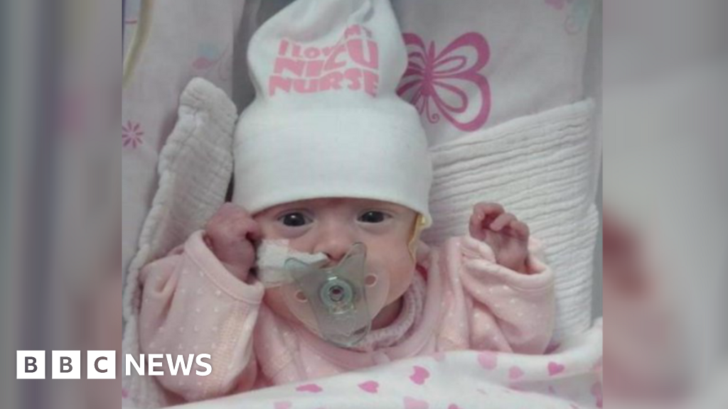 Sepsis test could cut diagnosis time from days to minutes - BBC News