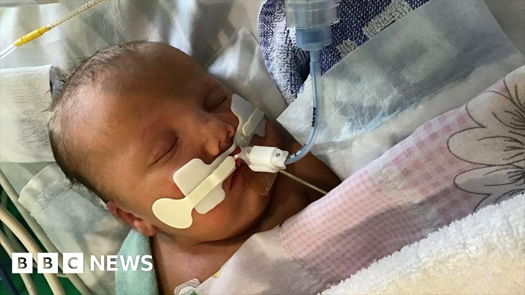 Genetic testing: Baby's condition is so rare it has no name - BBC News