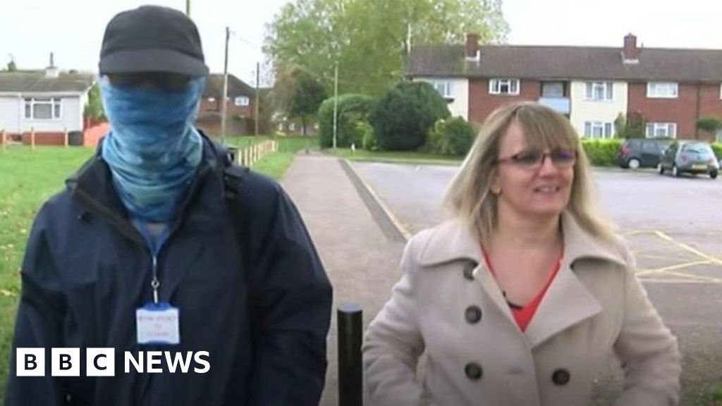 Basingstoke man Jordan Fretwell is allergic to UV light - BBC News