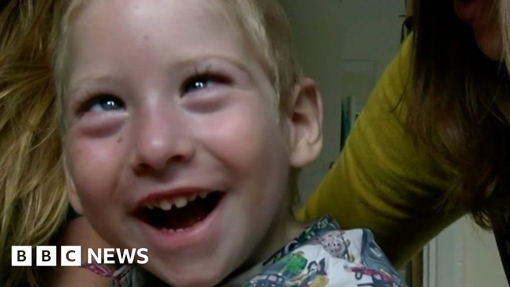 Isaac Mansfield: The boy living with an unnamed syndrome - BBC News