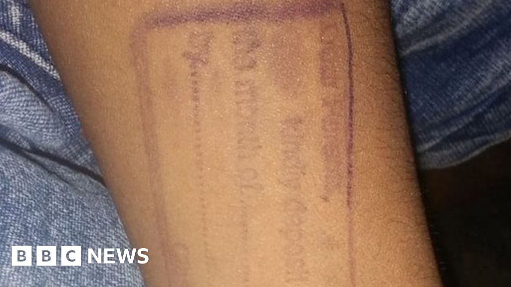 India school stamps child's arm over fee delay - BBC News