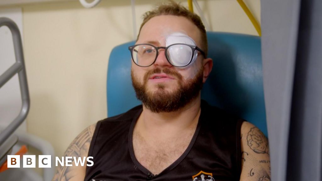 Saving Lives in Cardiff: Baseball bat attack victim's sight saved by ...