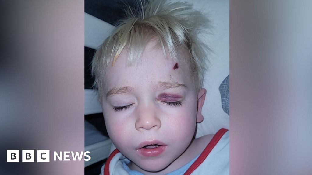 Toddler injured after pushchair's brakes fail near reservoir - BBC News