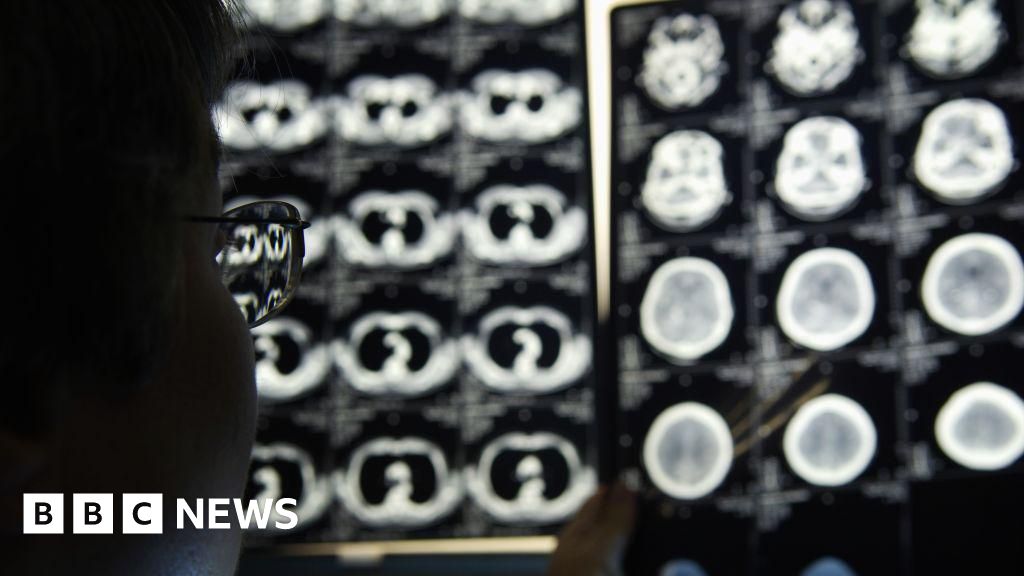 Hundreds of CT scans reviewed amid concerns about work of radiologist