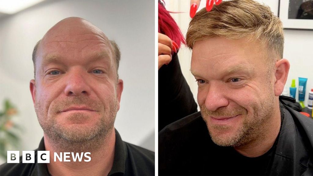 'We need to break the stigma around toupees'