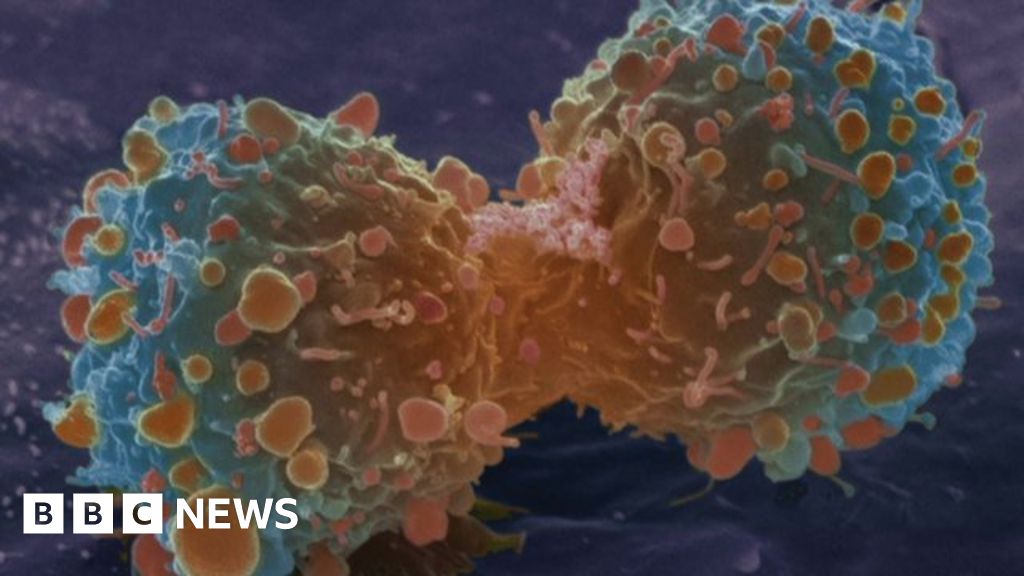 Study suggests cancer is not 'just bad luck' - BBC News