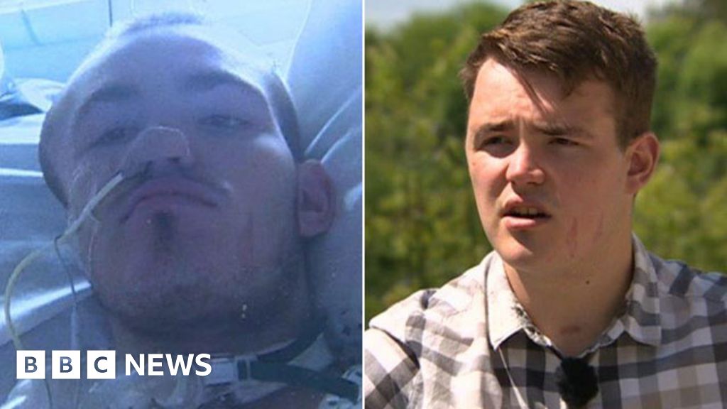 Student rugby player Angus Swanson back from paralysis - BBC News