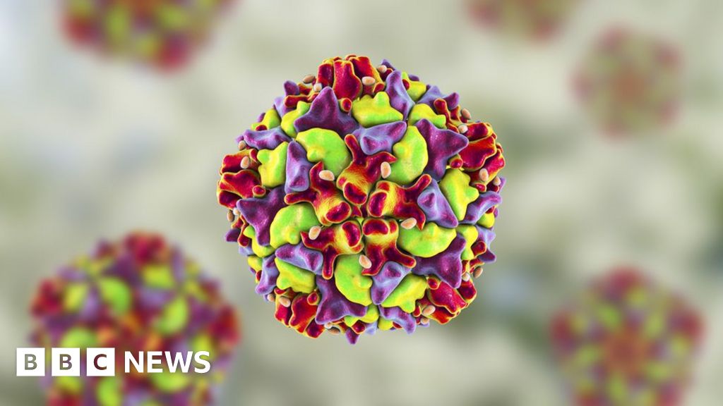 Polio: Virus found in wastewater of New York City suburb