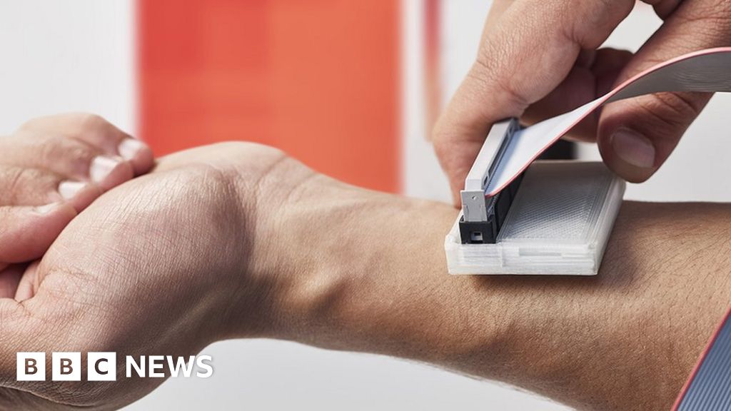 Skin cancer-detecting device wins 2017 James Dyson award - BBC News